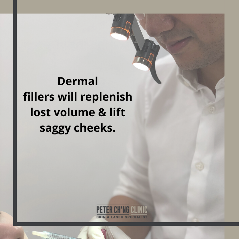 Patient Mailbox: Treating Sunken Cheeks with Dermal Fillers | Peter Ch ...